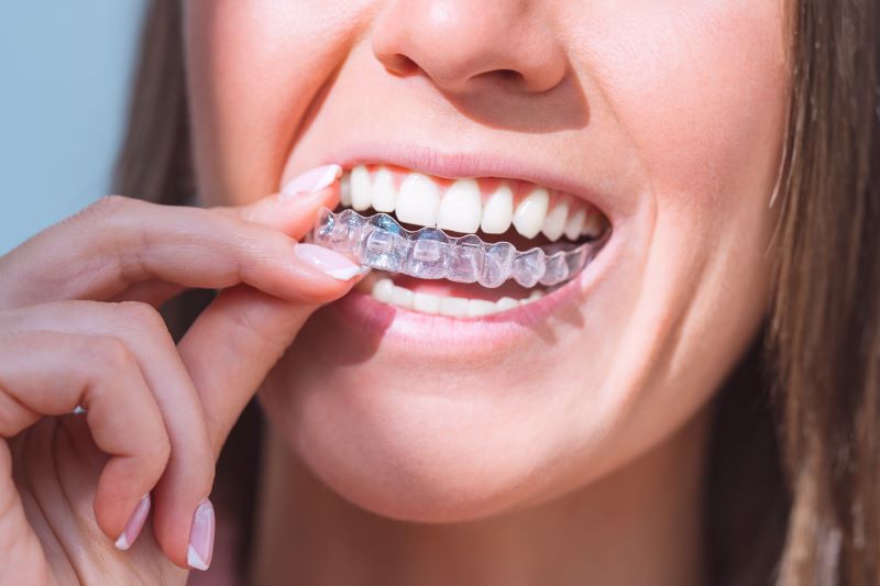 Can Invisalign Correct TMJ Disorder?